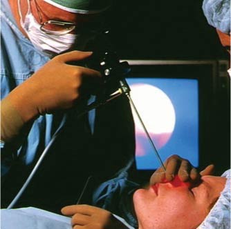 Medical Imaging Solutions for Endoscopy from Neologiq